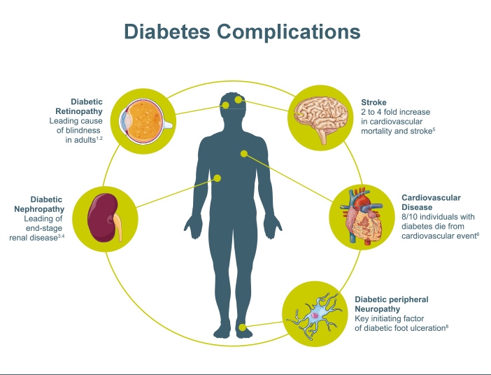 SUDOSCAN & Diabetes - Impeto Medical - SUDOSCAN & EZscan